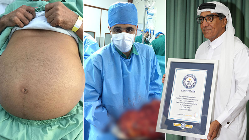 The extreme human body records that made our jaws drop in 2017 ...