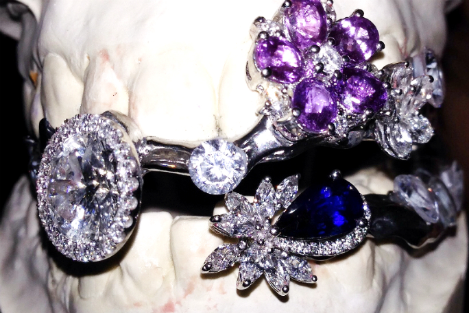 Million-dollar teeth grill worn by Katy Perry is confirmed as most ...