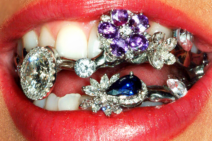 Million-dollar teeth grill worn by Katy Perry is confirmed as most ...