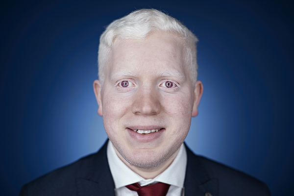 "We are a team": Six siblings with albinism break world record ...