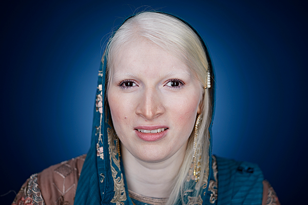 "We are a team": Six siblings with albinism break world record ...