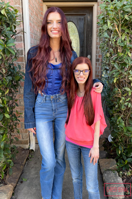"They’re so different even though they’re 'identical' twins" | Guinness ...