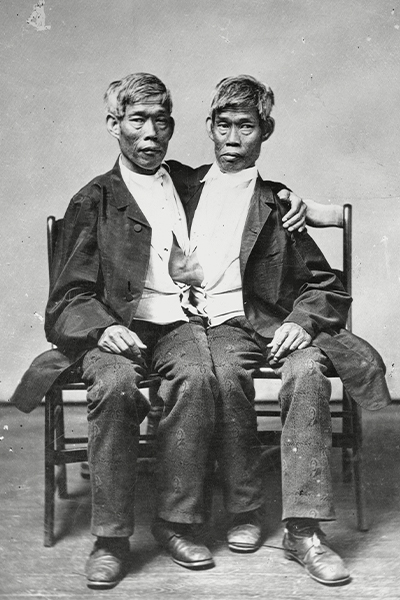 The dark history of the original Siamese twins, Chang and Eng Bunker | Guinness World Records