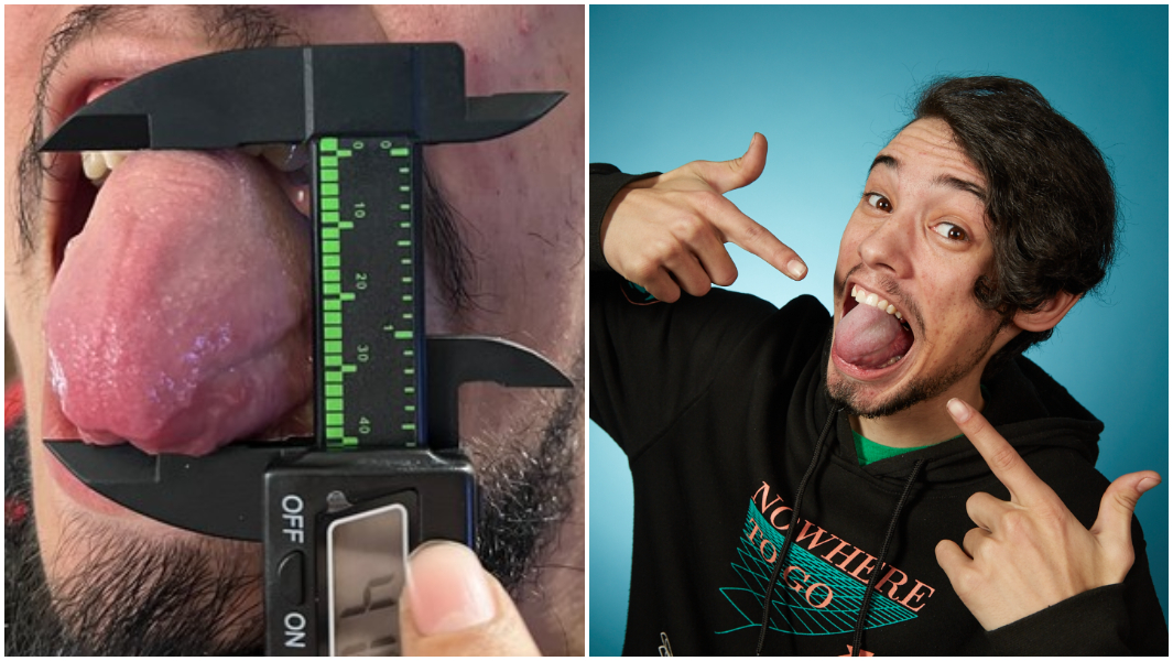 “My tongue is a gift”: Man’s massive tongue breaks world record ...