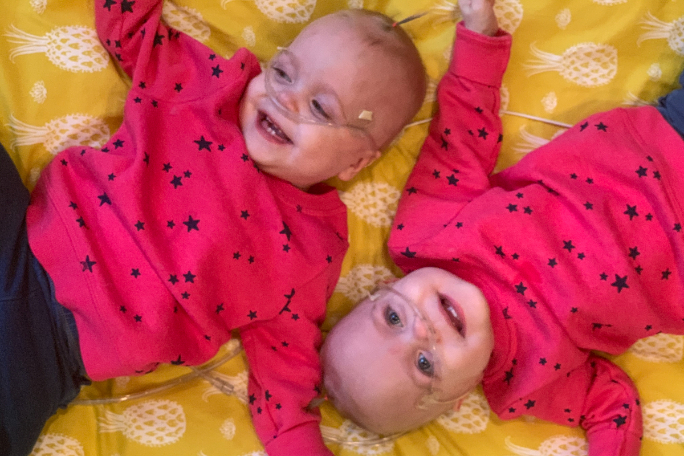 World's most premature twins now happy three-year-olds | Guinness World ...