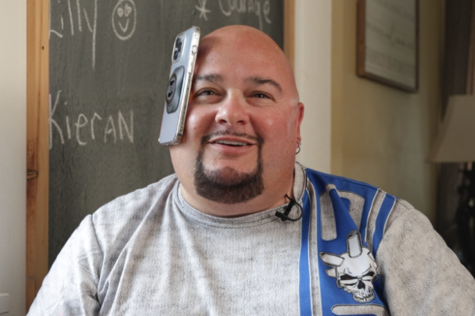 "I'm a real-life mutant": Jamie Keeton on his amazingly sticky skin ...