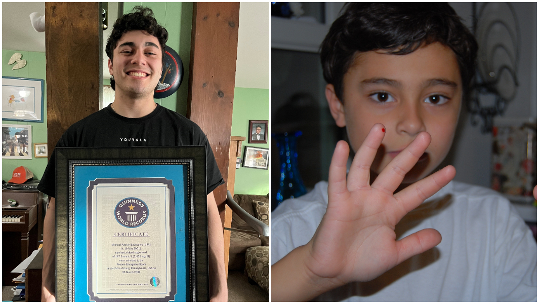 Miraculous survival of boy with blood sugar level 21 times higher than ...