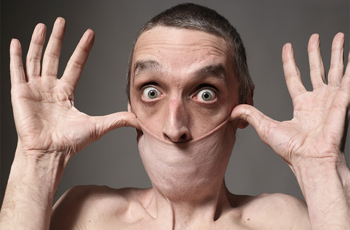 Man with world’s stretchiest skin embraces rare disorder that led to ...