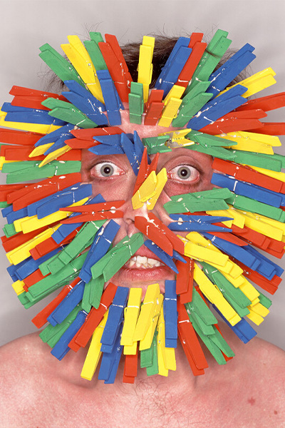 Man with world’s stretchiest skin embraces rare disorder that led to ...