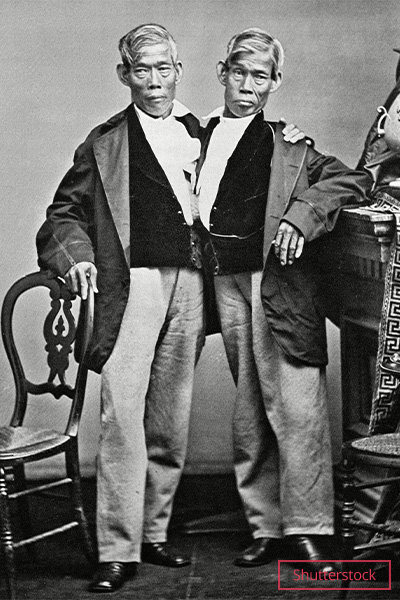 Twin expert says Barnum banned 'Siamese twins' Chang and Eng from ...