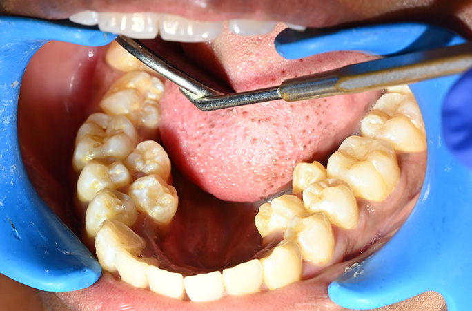 Indian mother sets world record for having the most teeth | Guinness ...