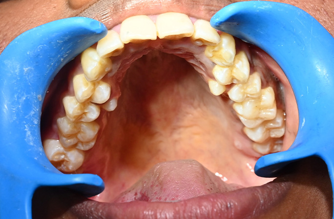 Indian mother sets world record for having the most teeth | Guinness ...