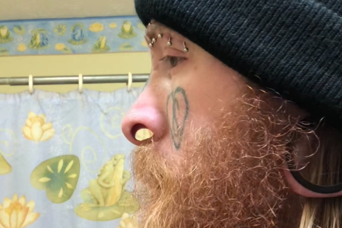 “Patience is the key”: Man with largest nasal septum flesh tunnel ...