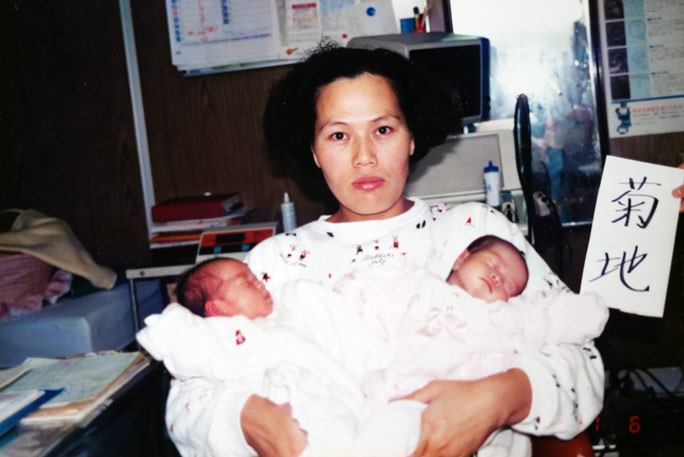 Twins with staggering 75 cm height difference are close as two sisters ...