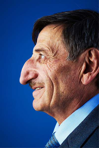 Man “blessed” with world’s longest nose dies suddenly at age 75 ...