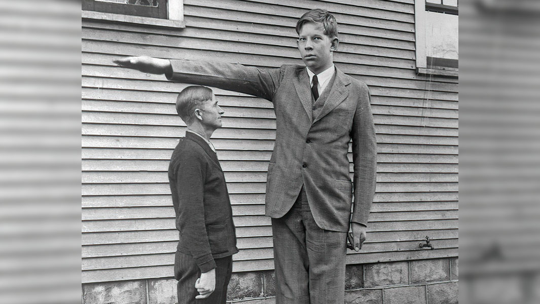 Robert Wadlow Hands Size