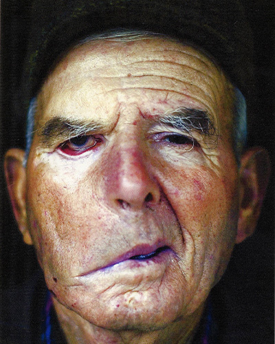 Texas man shot in face as a child lived with bullet in his head for 94 ...