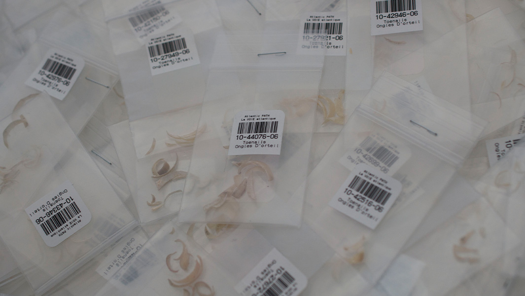 Got your toe(nails)! Scientific study holds largest collection of ...