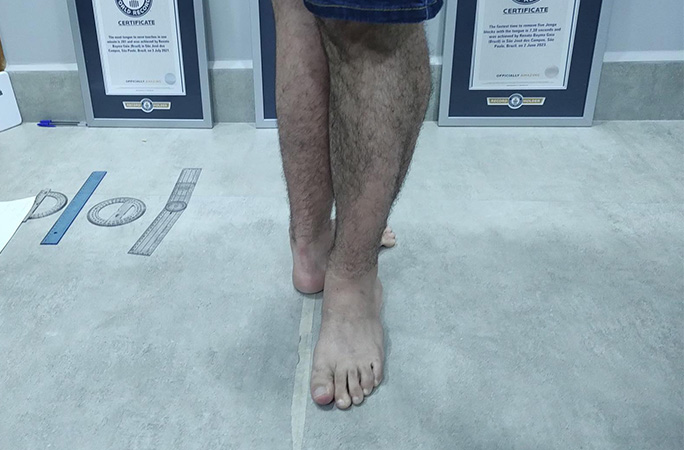 Brazilian man twists foot 210 degrees to smash world record | Guinness ...