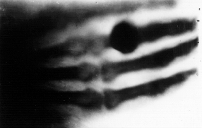 First x-ray | Guinness World Records