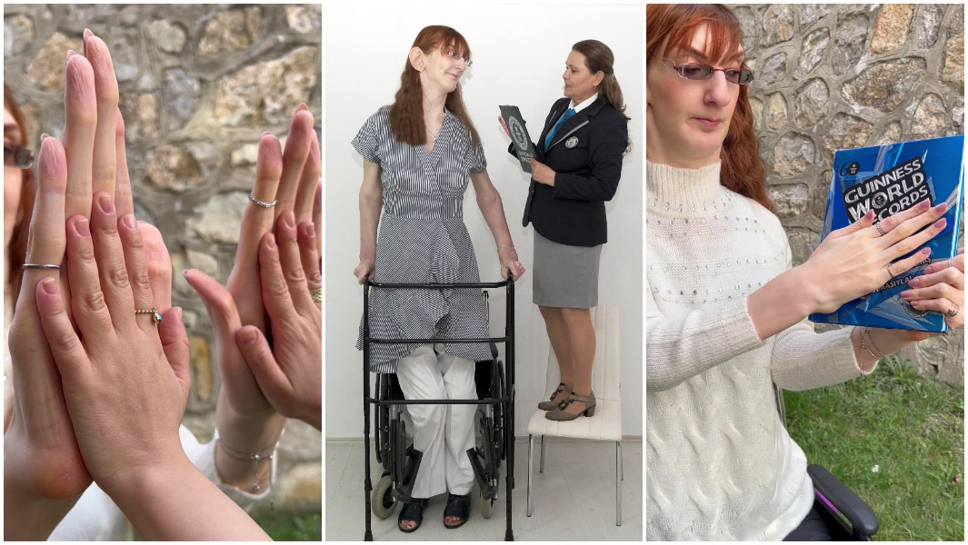 Widest hand span on a living person (female) | Guinness World Records