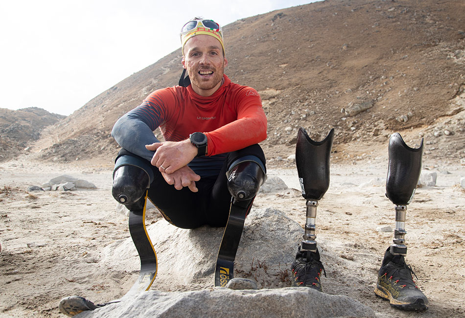 First multiple amputee to climb Everest LA4 - multiple finger ...